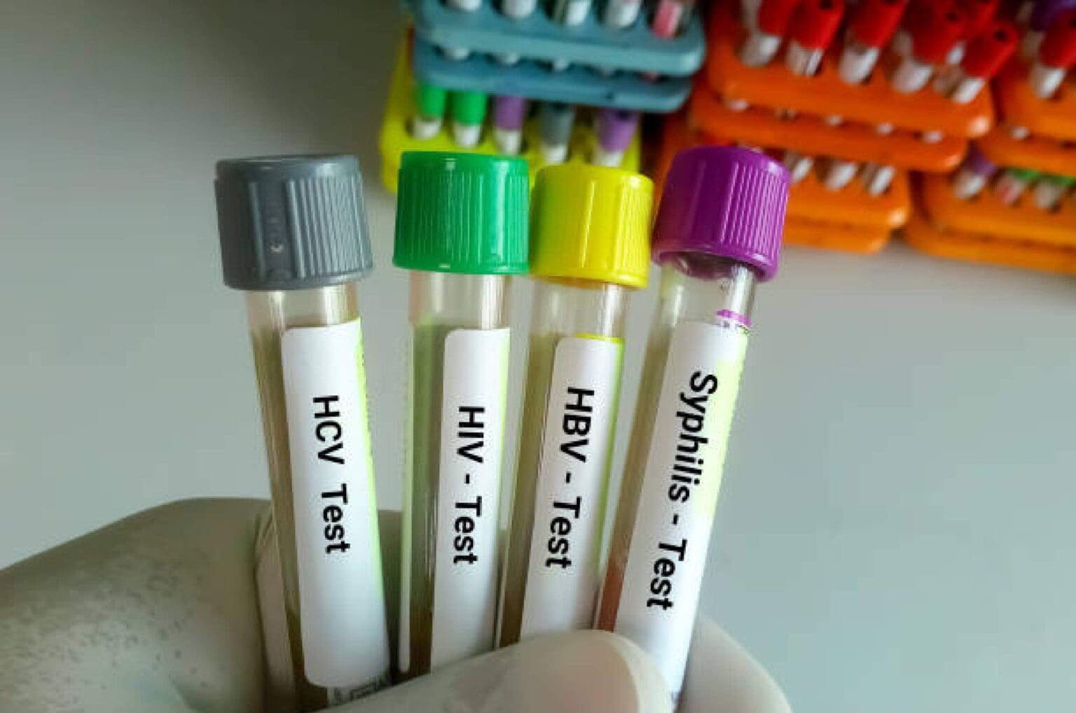 Confidential STD Checks Narangba | STD & STI Tests | NSMC